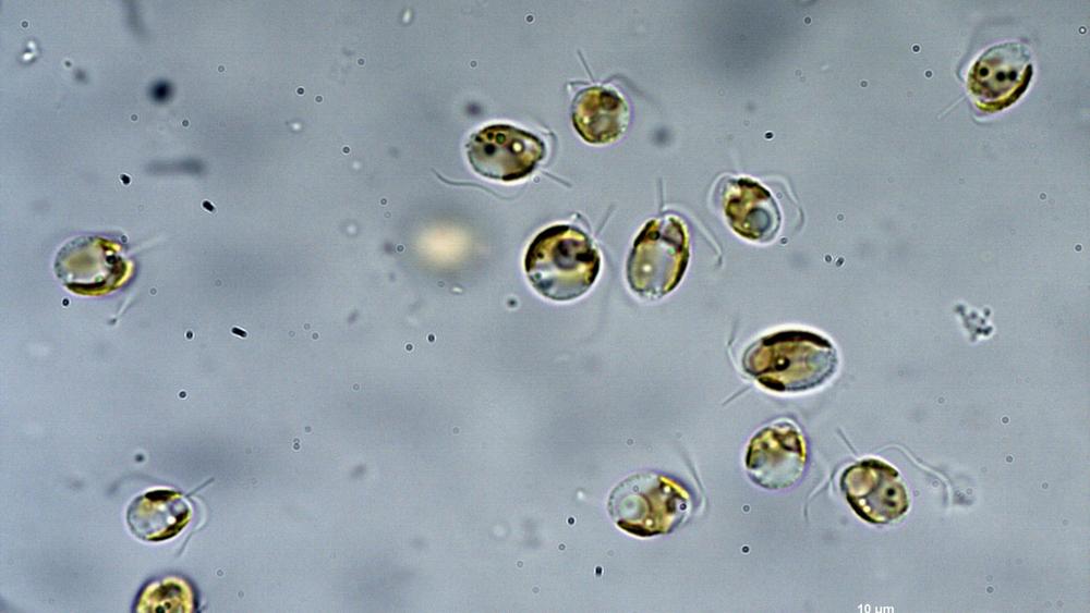 Massenentwicklung von Prymnesium parvum nur in salzbelasteten ...