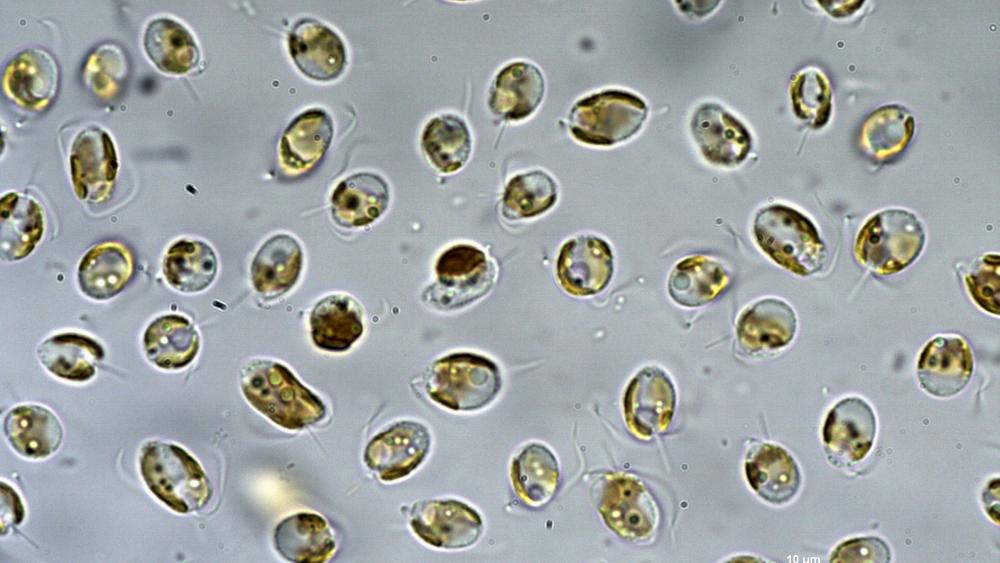 Oder River disaster: What is known about the alga Prymnesium parvum? | IGB